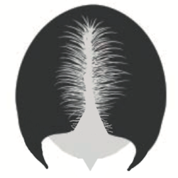 女性の薄毛（FAGA）治療 - makiスキンケアクリニック - 八王子の美容皮膚科